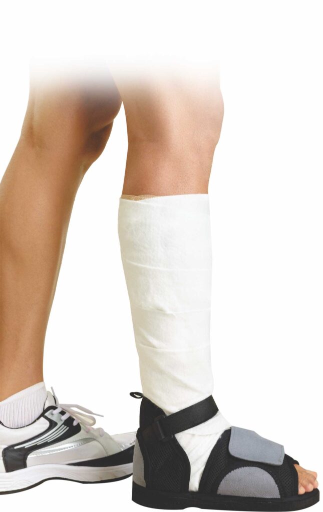 DYNA Cast shoe - Nanak Surgical Enterprises